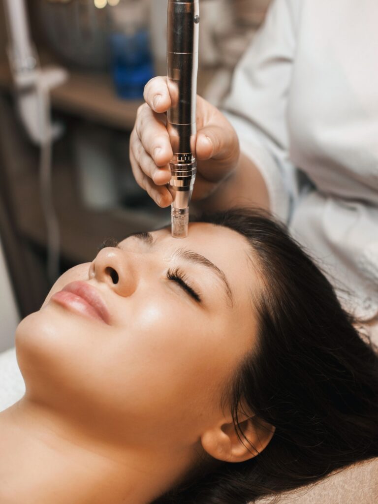 Microneedling Results: How Long It Takes & What to Expect