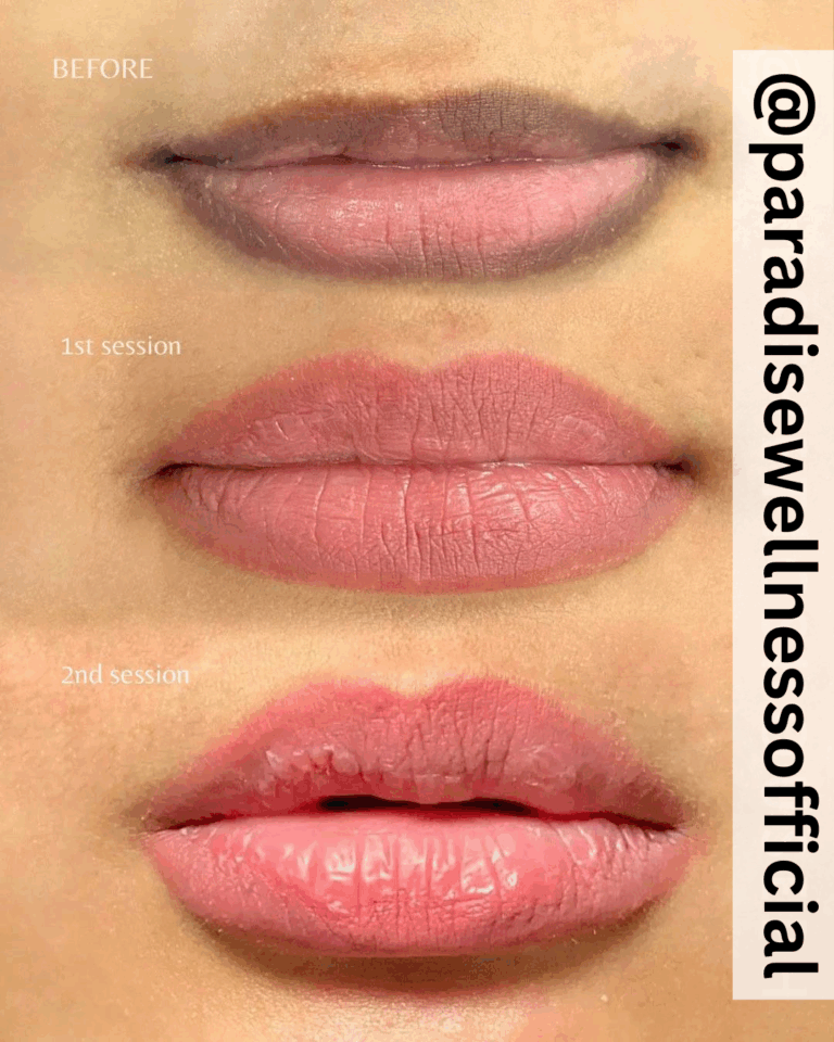 Want Pink Lips Fast? 5 Best Pink Lip Treatments for Rosy, Soft Lips